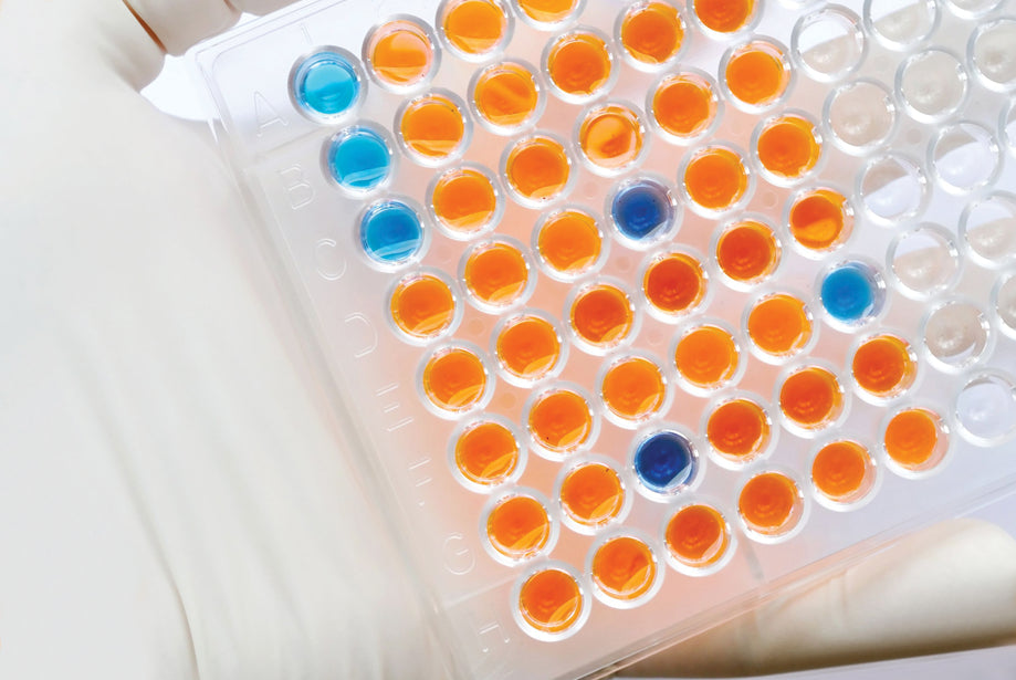 ELISA: ¿Qué es? ¿En qué consiste? ¿Cuáles son los distintos tipos de e ...